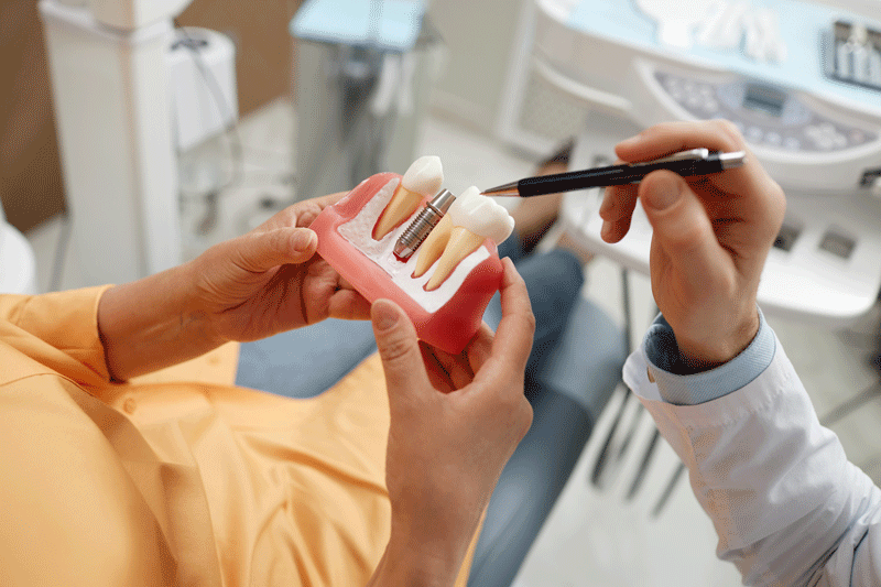 For Dental Implants, How Long Should A Temporary Prosthesis Be Worn ...